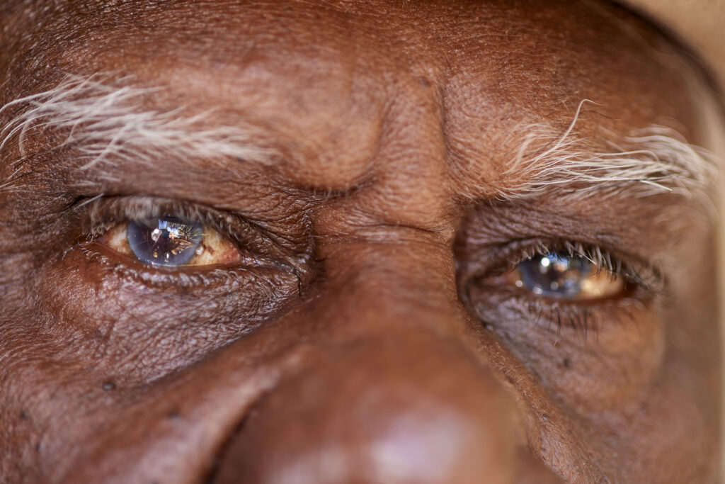 AI and the Outback: A vision for smarter, more equitable eye care in ...